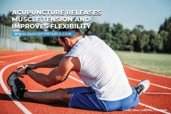 The Benefits of Acupuncture for Athletes | The Physiotherapy and ...
