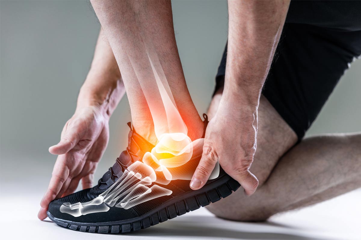 What Everyday Movements Put the Most Strain on Your Arches? | The ...